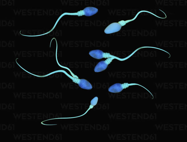 How do sperm ducts get blocked? – Sperm Blockage Causes – Doctor Omar ...